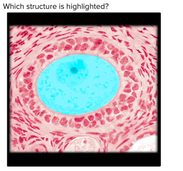 Solved Which structure is highlighted? 4 Which structure | Chegg.com