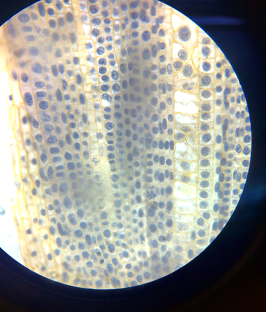 Solved Observe the tip of the onion root at the highest | Chegg.com