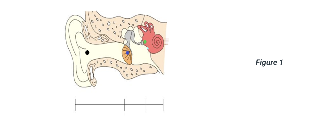Solved Figure 1 ﻿Transfer Function of Outer Ear CanalFigure | Chegg.com