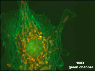 Solved 100x red channel 100% green channel | Chegg.com