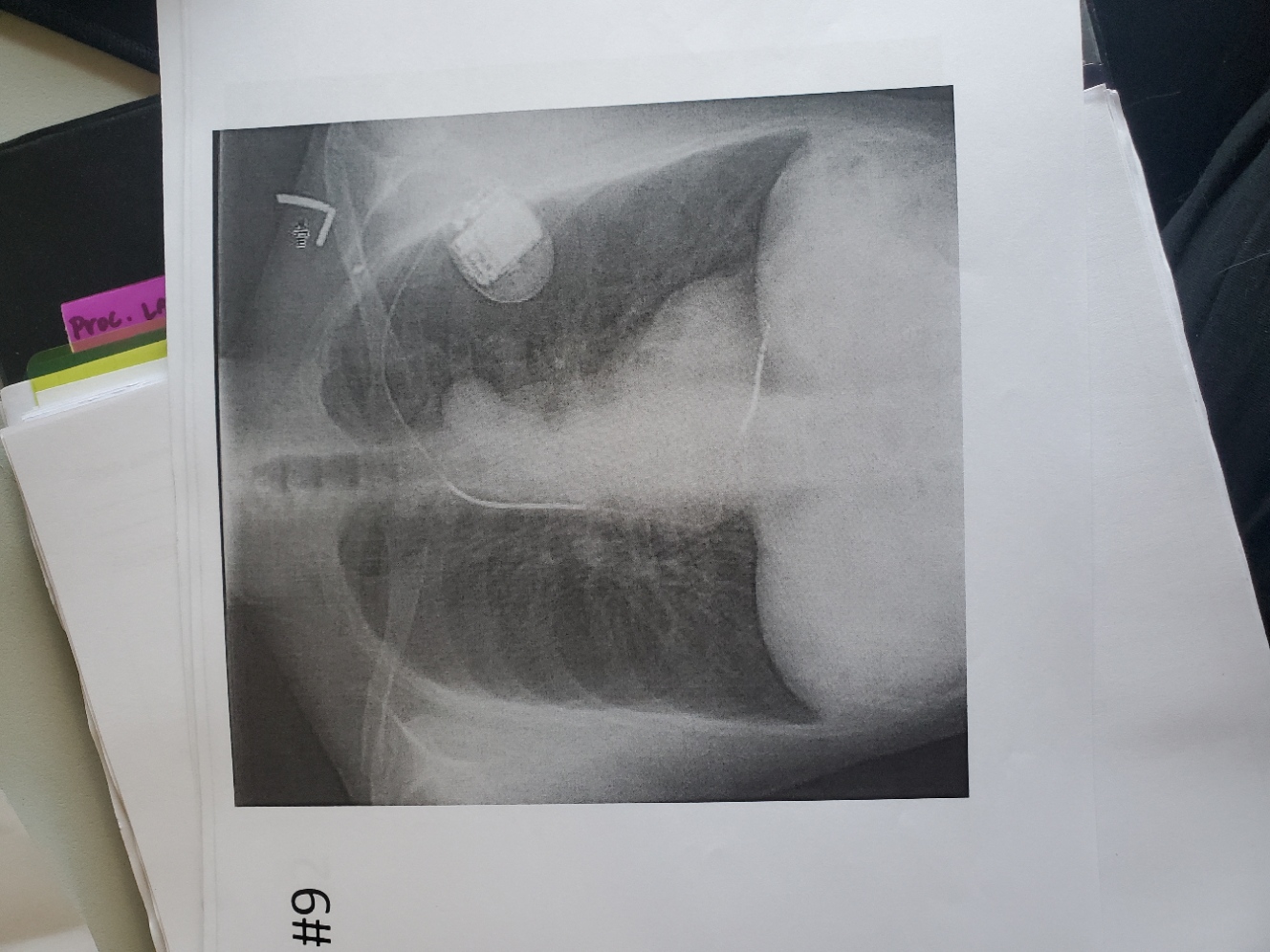 9- interpret this CXR and explain reasoning behind | Chegg.com