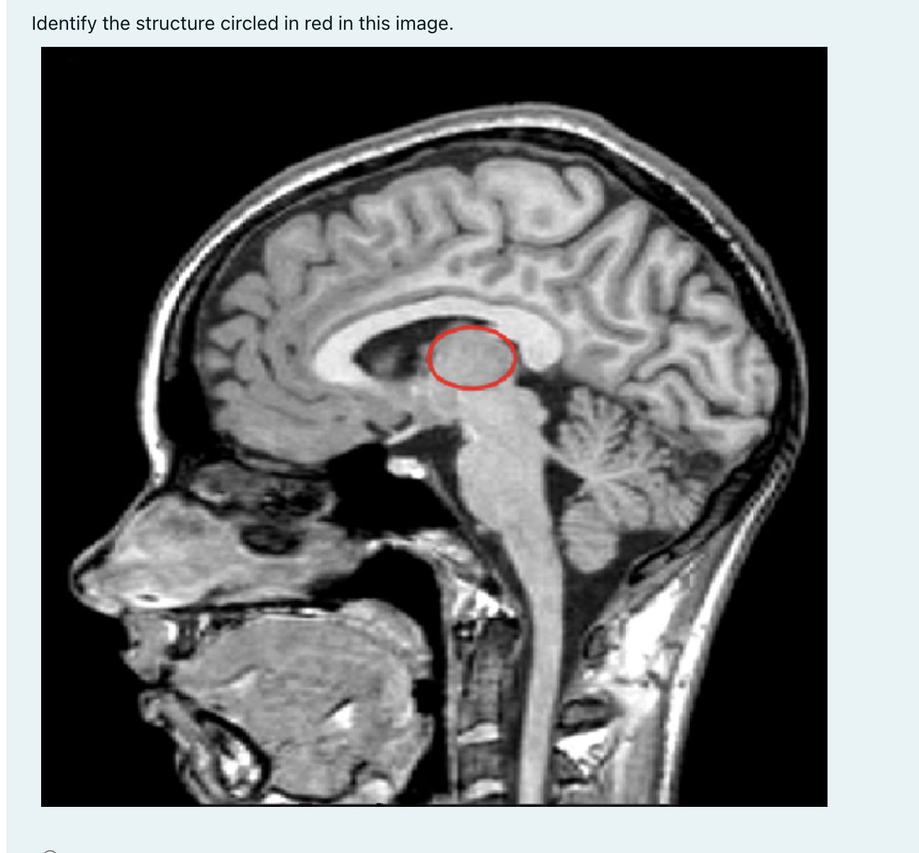 Solved Identify the structure circled in red in this image. | Chegg.com