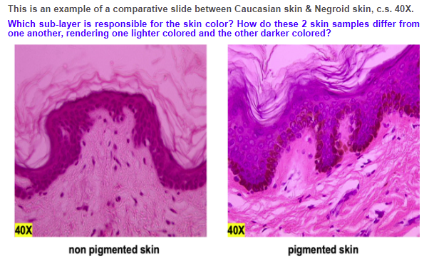 Solved This is an example of a comparative slide between | Chegg.com