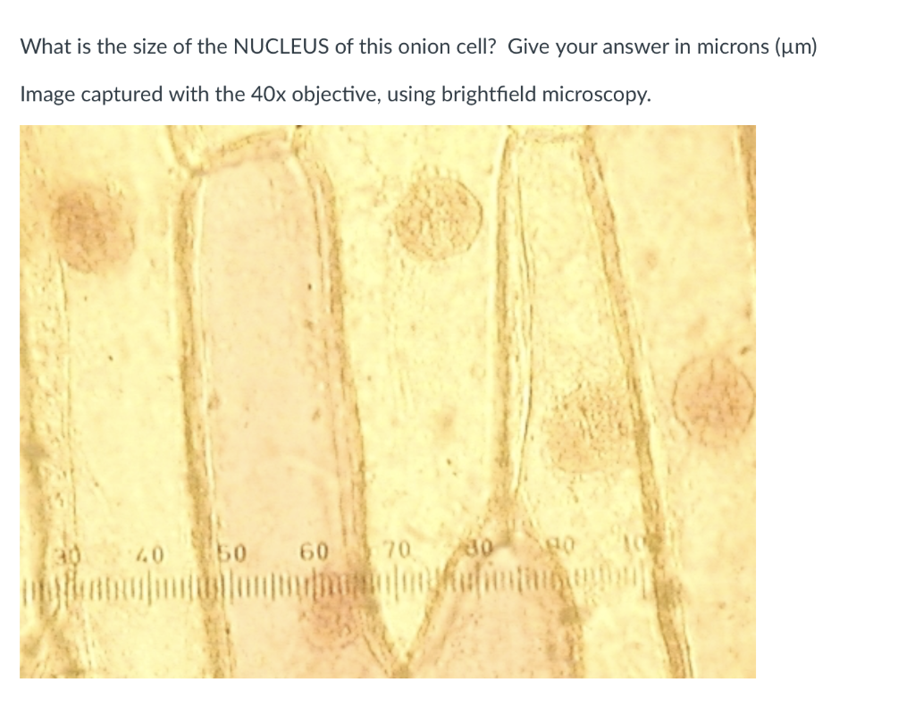 Solved What is the size of the NUCLEUS of this onion cell? | Chegg.com