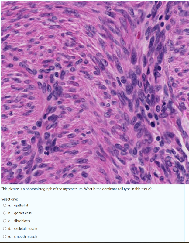 Solved This picture is a photomicrograph of the myometrium. | Chegg.com