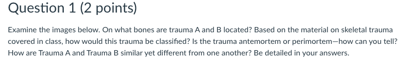 Solved Examine the images below. On what bones are trauma A | Chegg.com