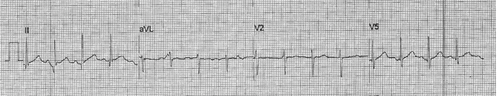 Solved Use 2 methods to estimate the heart rate. 1. sequence | Chegg.com
