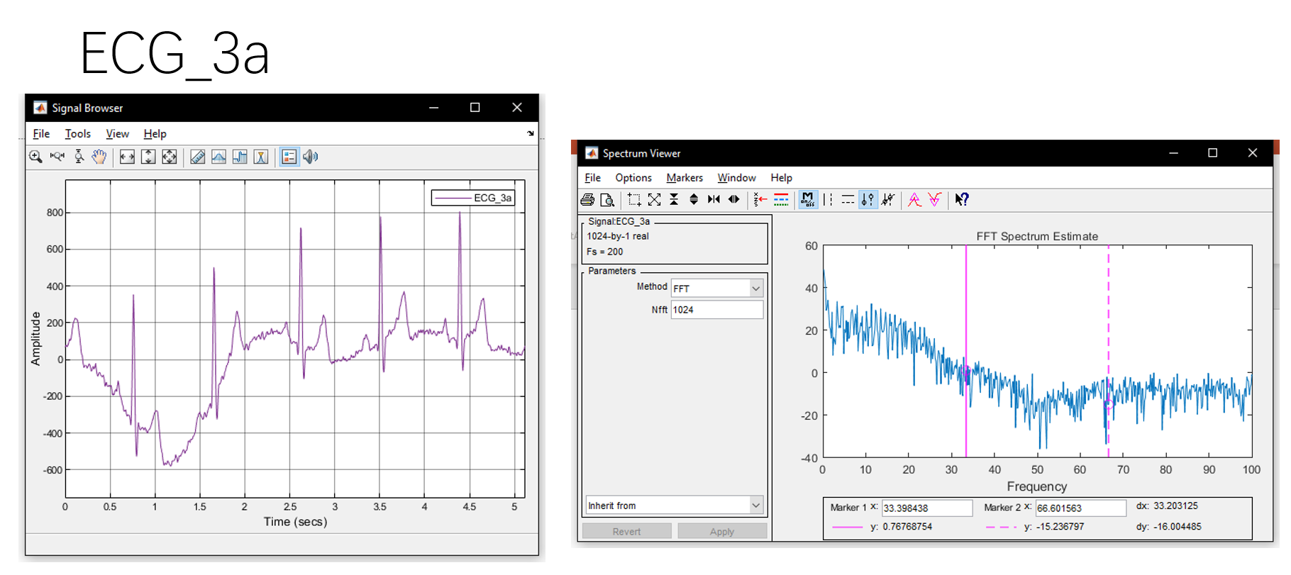 ECG 3a Signal Browser File Tools View Help Ik NX E X | Chegg.com