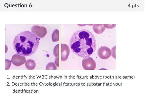 Solved Question 6 4 pts 1. Identify the WBC shown in the | Chegg.com