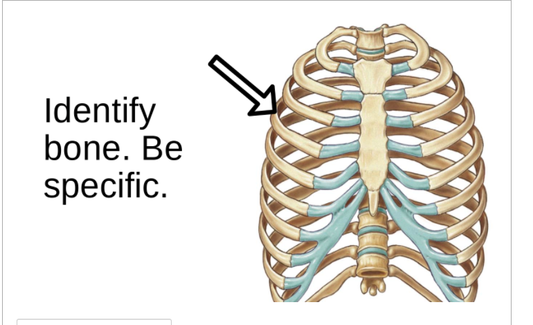 Solved Identify bone & bony landmark Identify bone & bony | Chegg.com