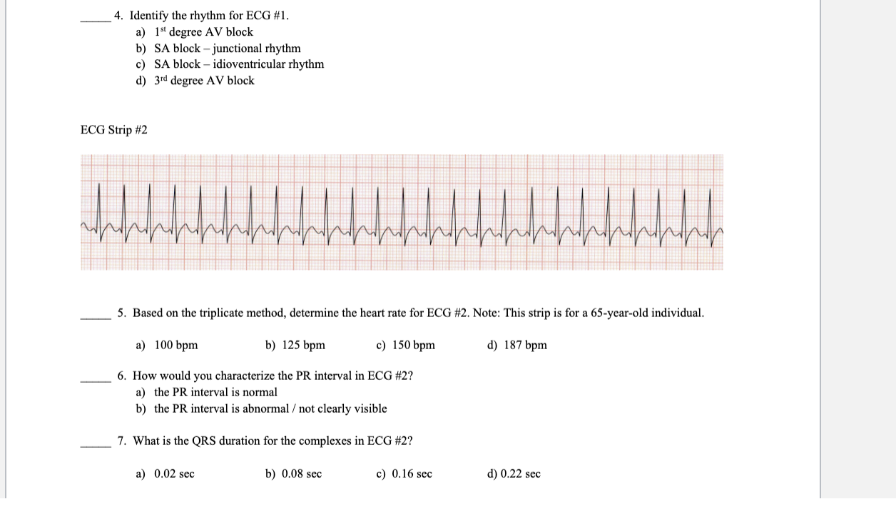 4. Identify the rhythm for ECG \#1. a) 1st degree AV | Chegg.com