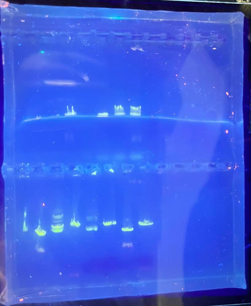 Do you observe a discreet band of DNA after | Chegg.com