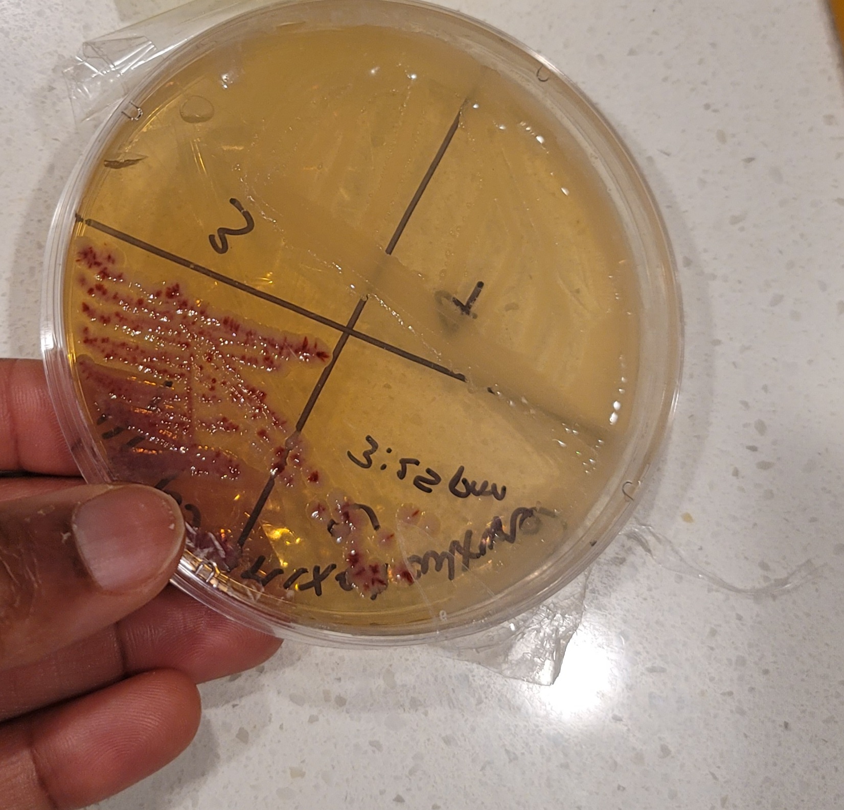 Solved Can you please include maximum colony characteristics | Chegg.com