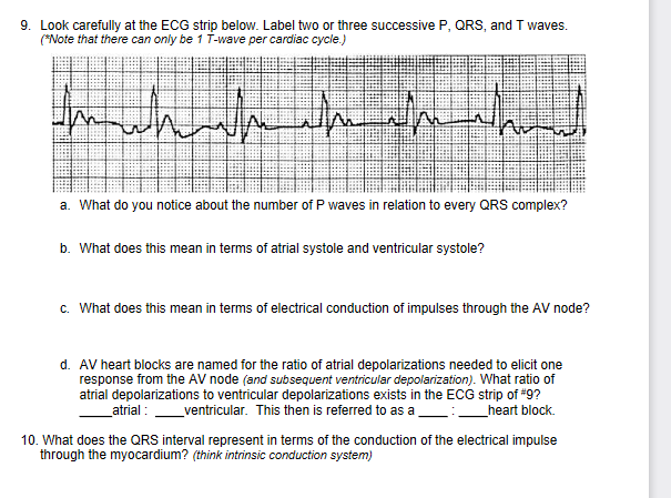 Solved 8. Measure the PR interval on the strip provided | Chegg.com