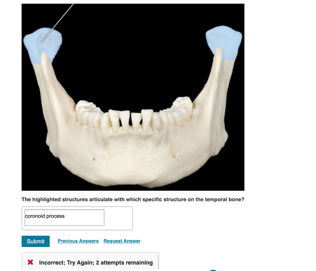Solved Identify the highlighted structure.Identify the | Chegg.com