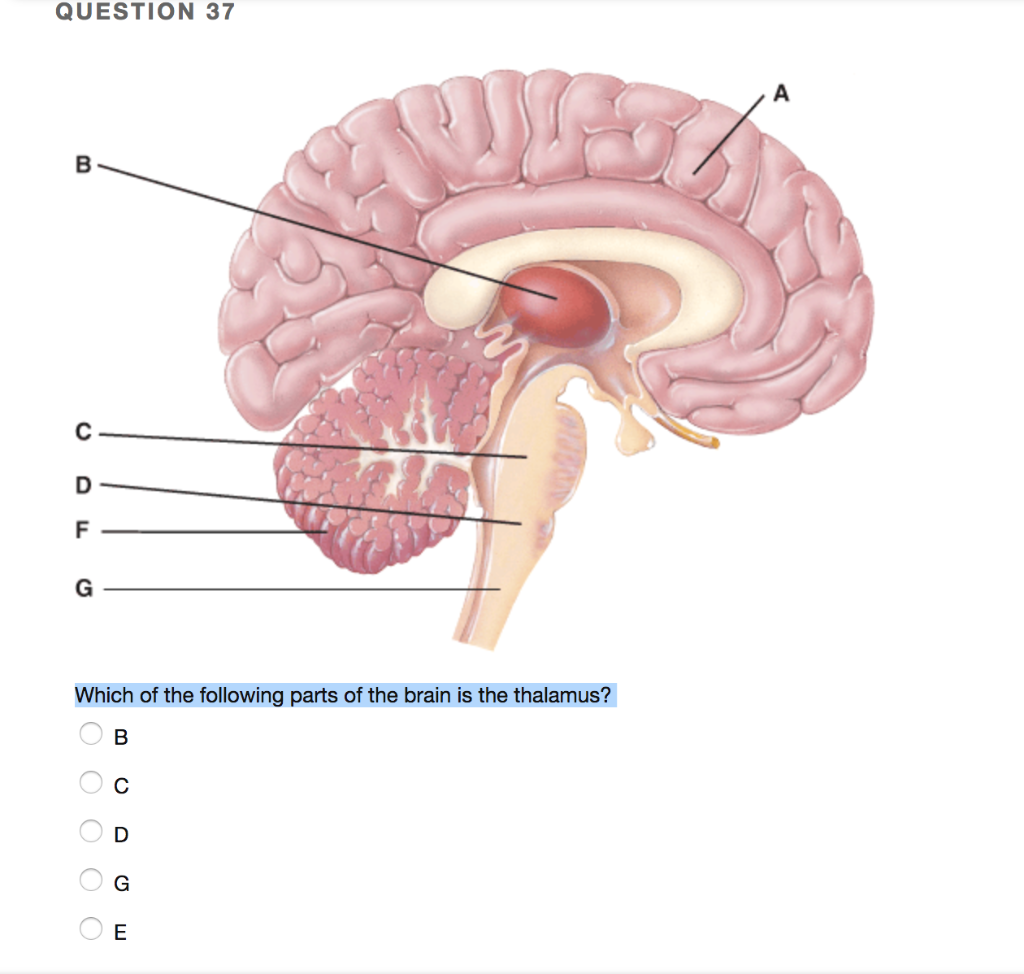 Solved QUESTION 30 Where is the posterior ramus? None of the | Chegg.com