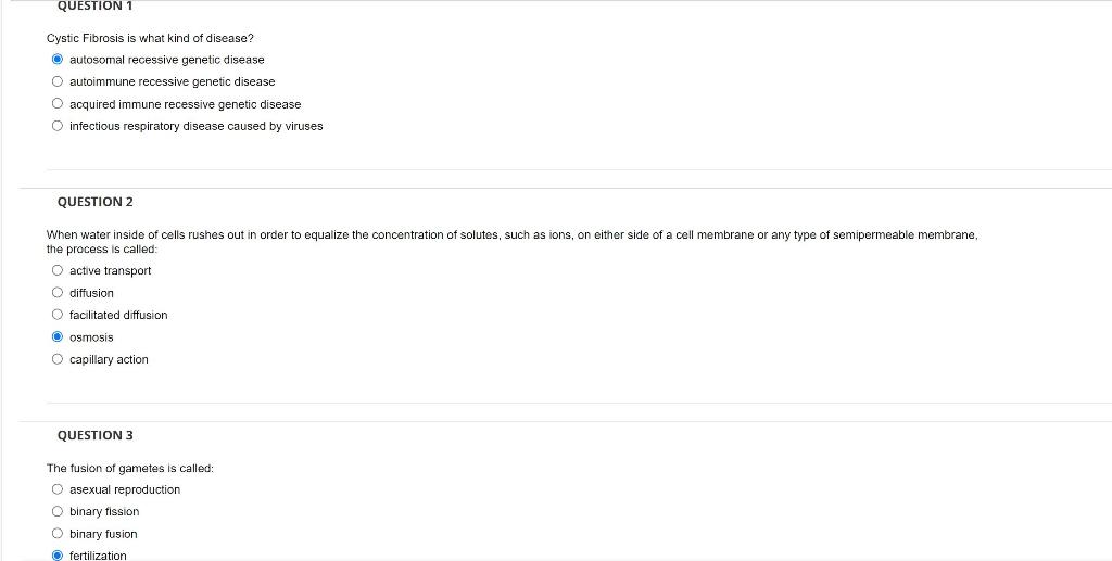 Solved Cystic Fibrosis is what kind of disease? autosomal | Chegg.com