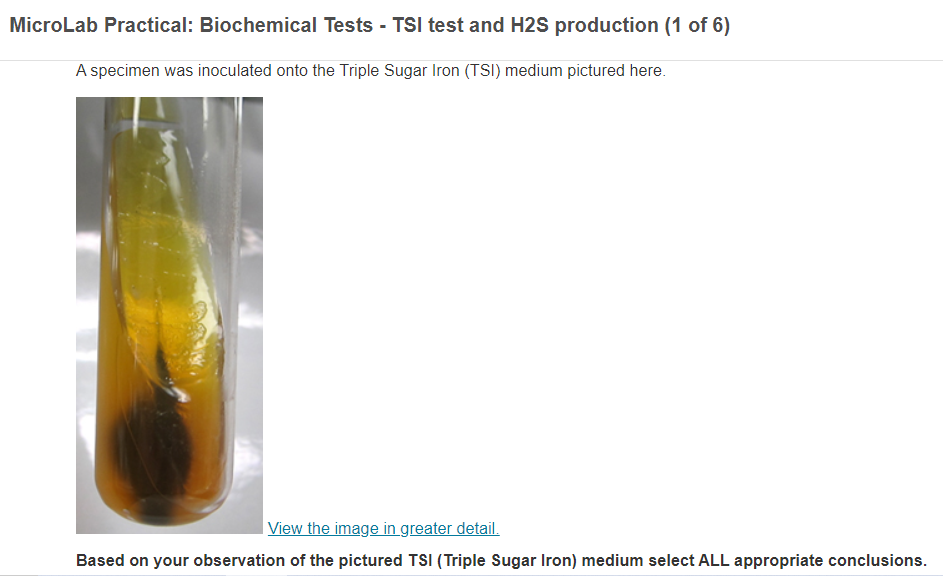 Solved MicroLab Practical: Biochemical Tests - TSI test and | Chegg.com