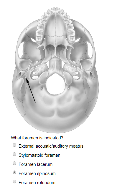 Solved What foramen is indicated? External acoustic/auditory | Chegg.com
