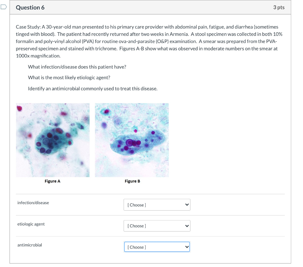 Solved Question 6 3 pts Case Study: A 30-year-old man | Chegg.com