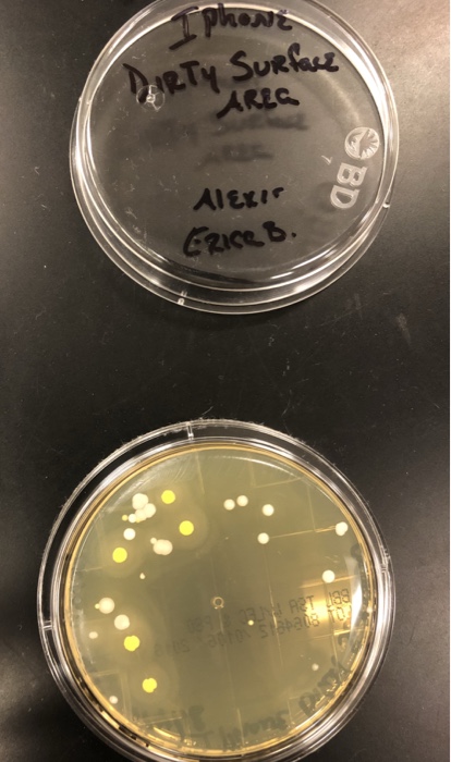 Solved Environmental sampling: cellphone screen using RODAC | Chegg.com