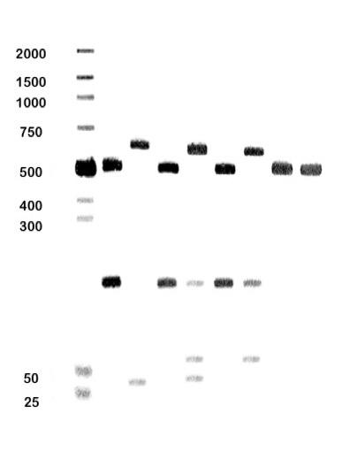 Lane # Sample Lane 1 DNA marker ladder Lane 2 Sample | Chegg.com