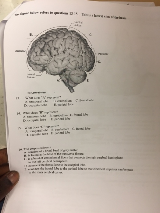 Solved: The Figure Below Refers To Questions 13-15. This I... | Chegg.com