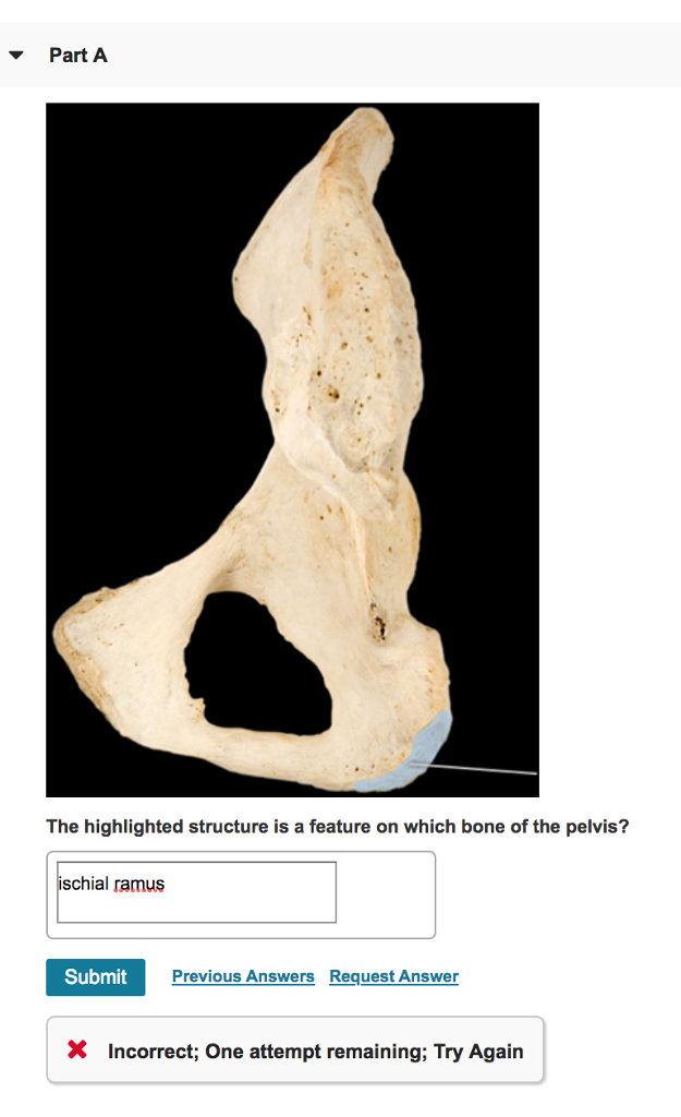 Solved PartA The highlighted structure is a feature on which | Chegg.com