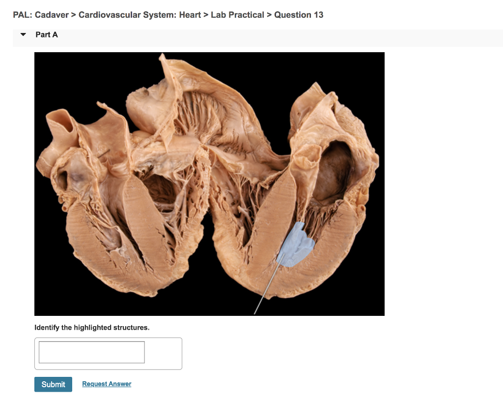 Solved PAL: Cadaver> Cardiovascular System: Heart>Lab | Chegg.com
