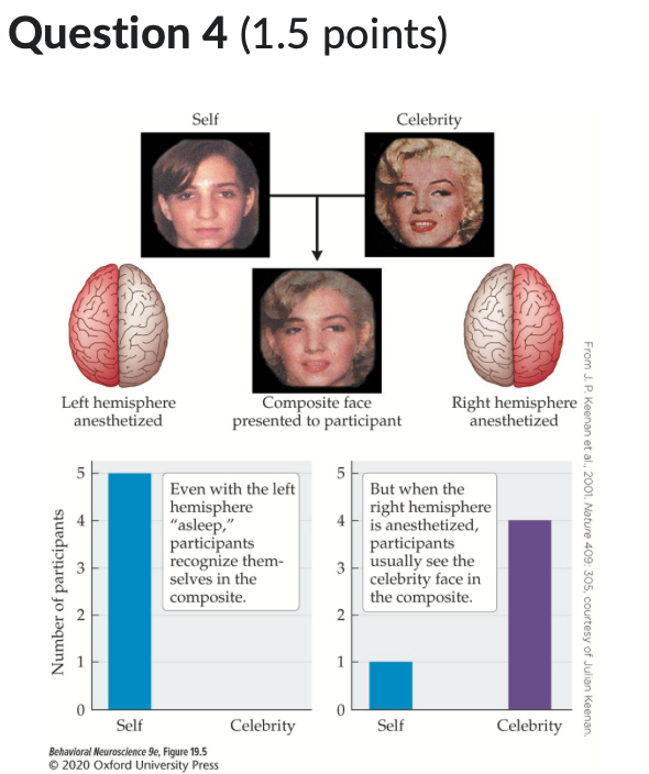 Solved The Wada test used in the context of face | Chegg.com