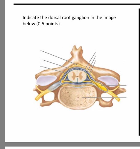 Solved Indicate the dorsal root ganglion in the image below | Chegg.com
