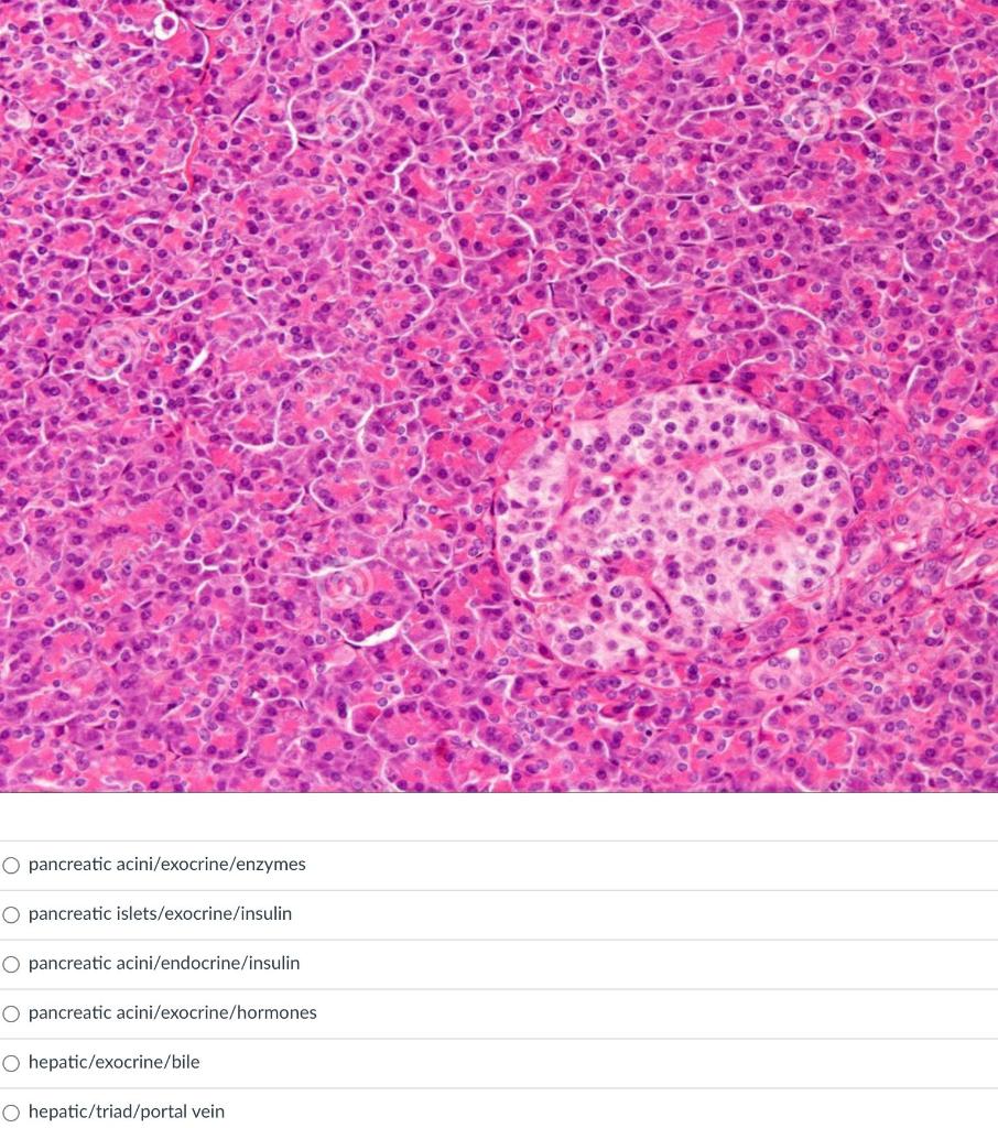 Solved O pancreatic acini/exocrine/enzymes O pancreatic | Chegg.com