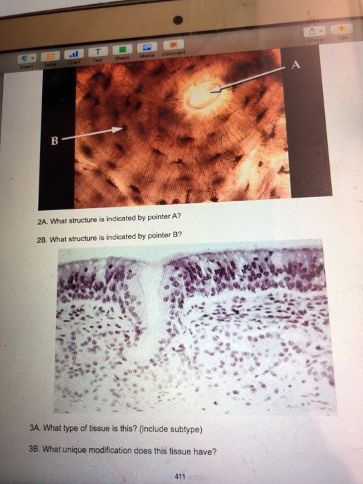 Solved 2A. What structure is indicated by pointer A? 2B. | Chegg.com