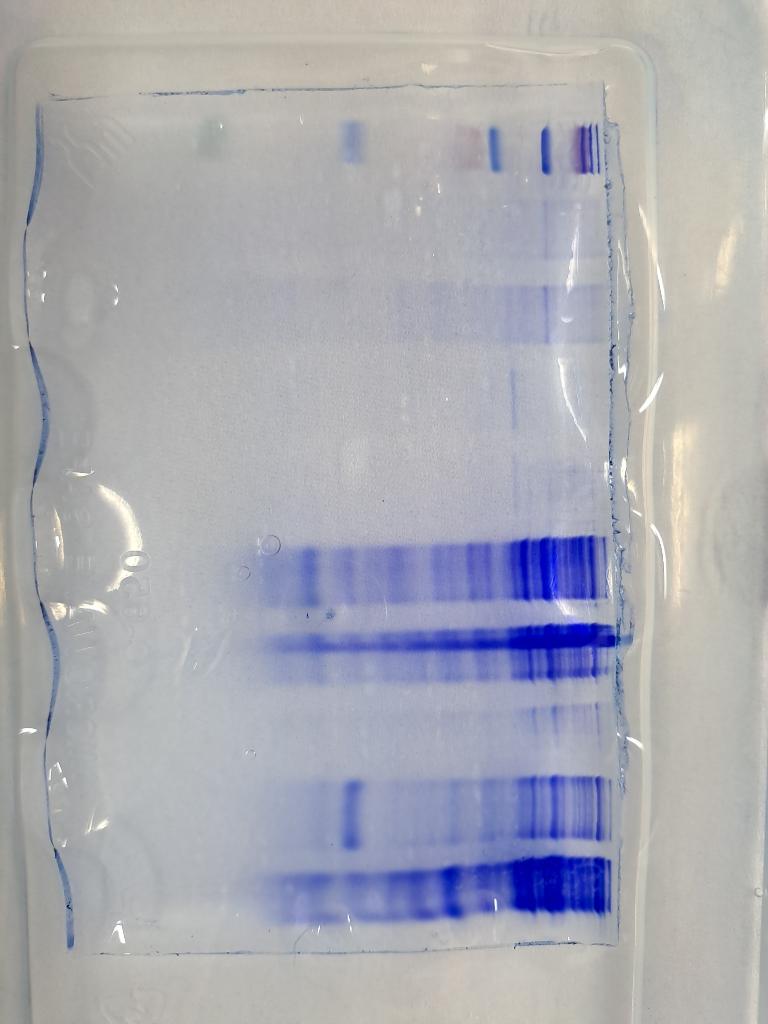 Solved PageRuler Prestained Protein Ladder Gel ||| kDa | Chegg.com