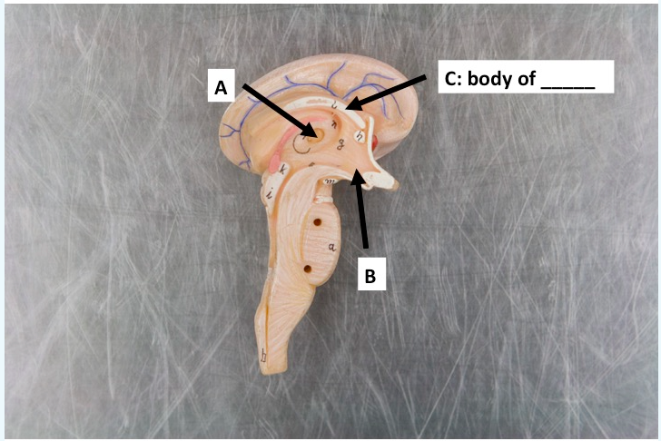 Solved A C: body of D a B | Chegg.com