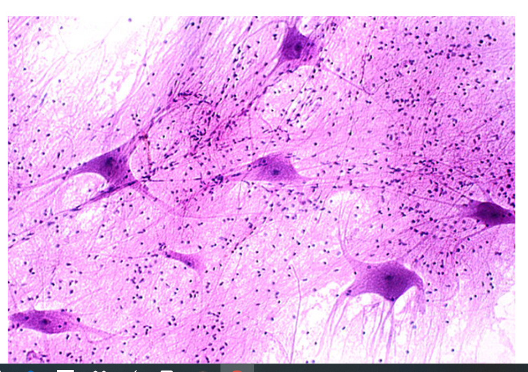 Solved Simple Squamous Epithelium Simple Cuboidal | Chegg.com