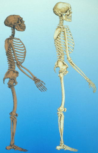 Neandertal Anatomy This is a comparison between a | Chegg.com