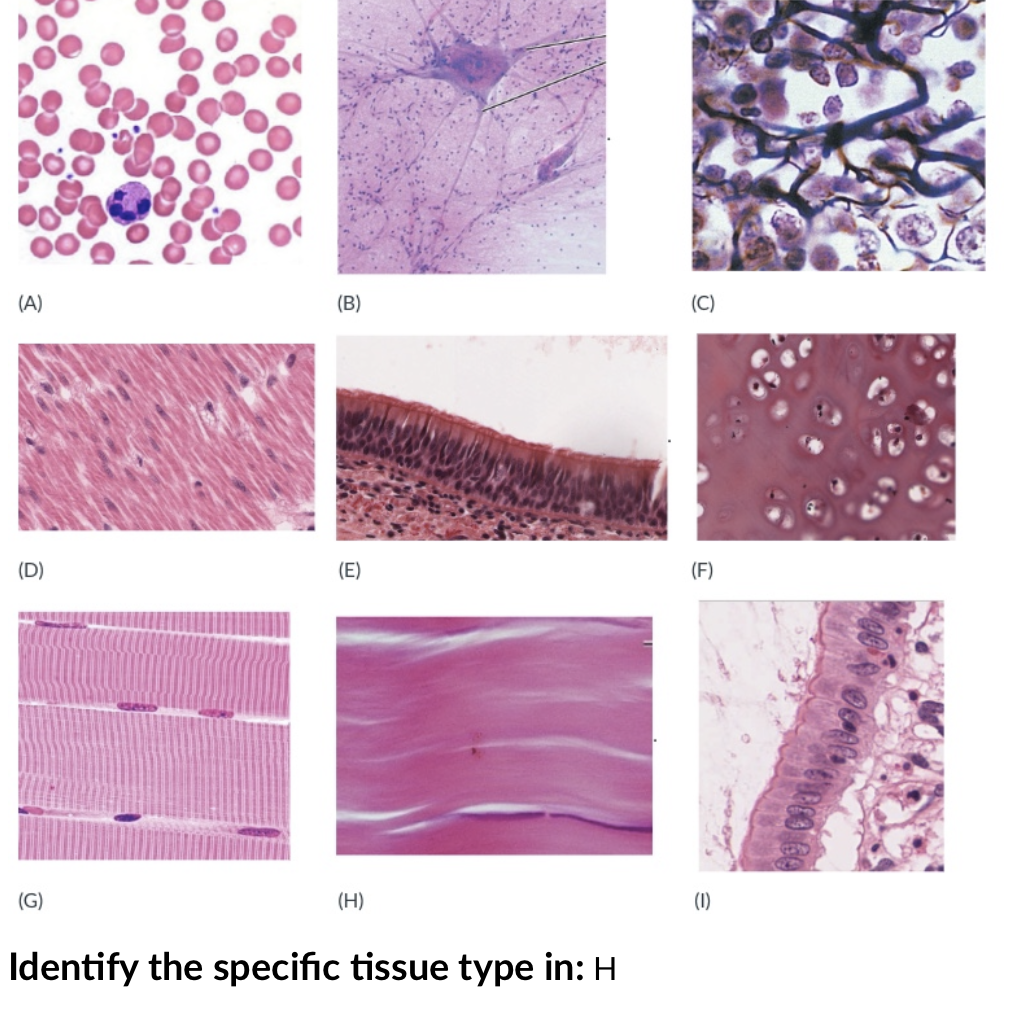Solved (A) (B) (C) (D) (E) (F) (G) (H) (I) Identify the | Chegg.com
