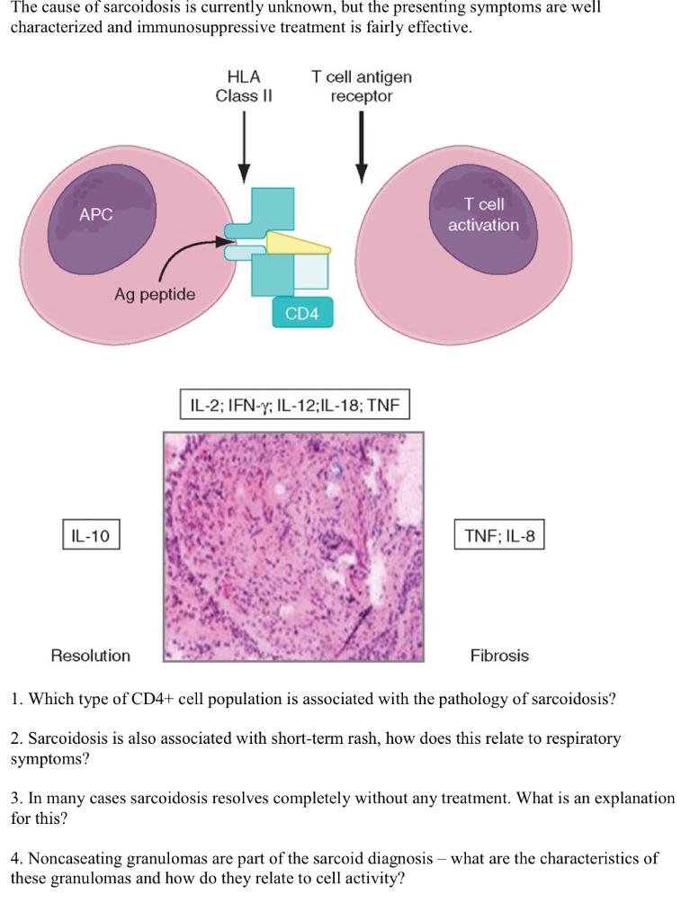 Solved The cause of sarcoidosis is currently unknown, but | Chegg.com