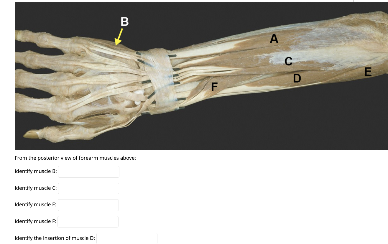 Solved From the posterior view of forearm muscles above: | Chegg.com