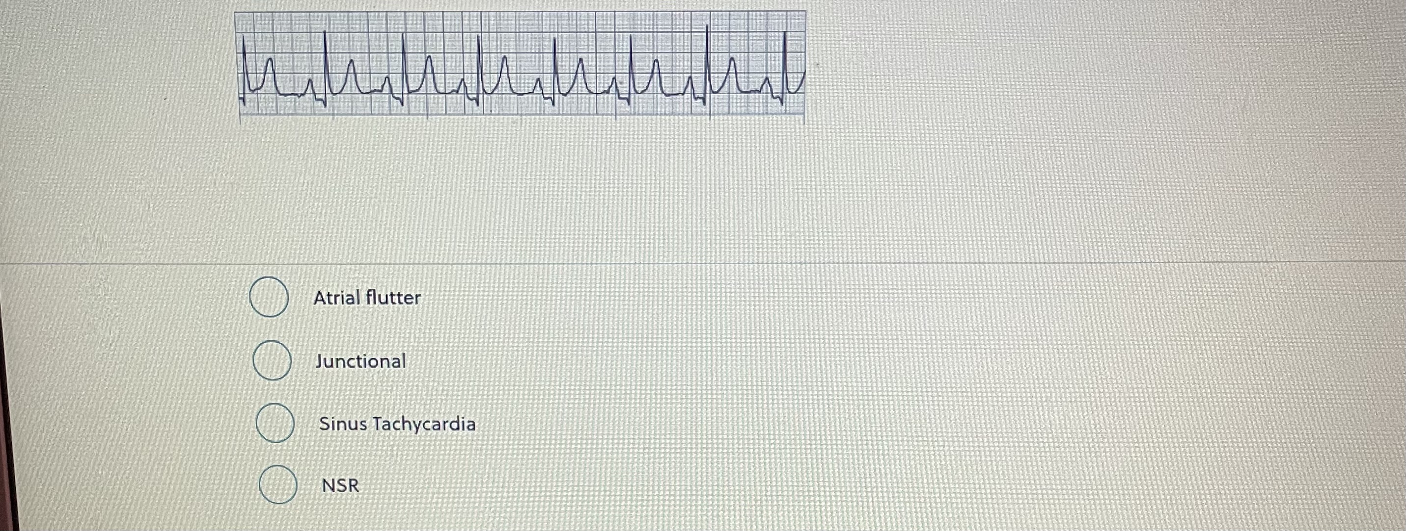 Atrial flutter Junctional Sinus Tachycardia NSR | Chegg.com