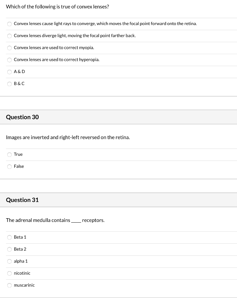 Solved Which of the following is true of convex lenses? | Chegg.com
