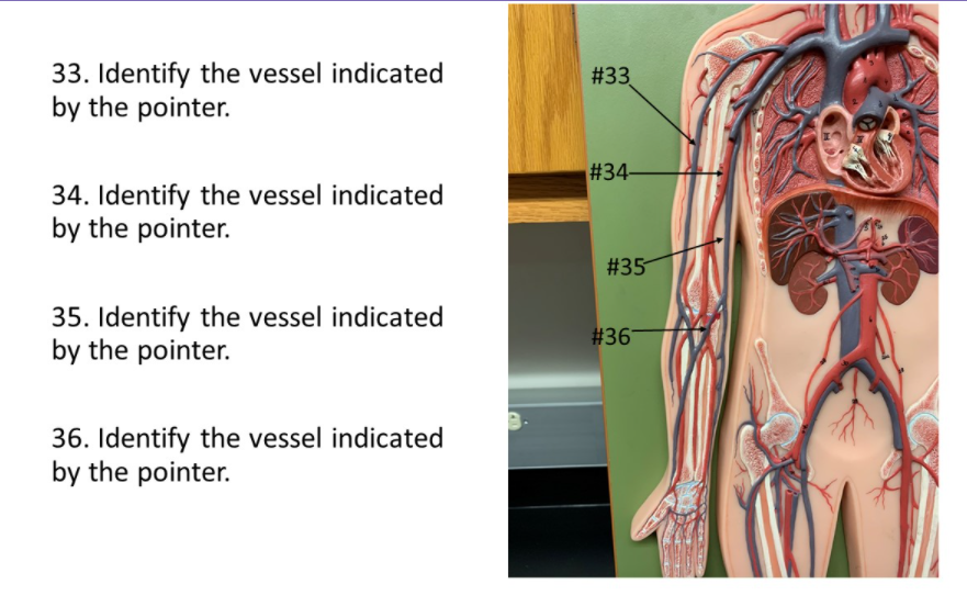 Solved 28. Identify the vessel indicated by the pointer. 29. | Chegg.com