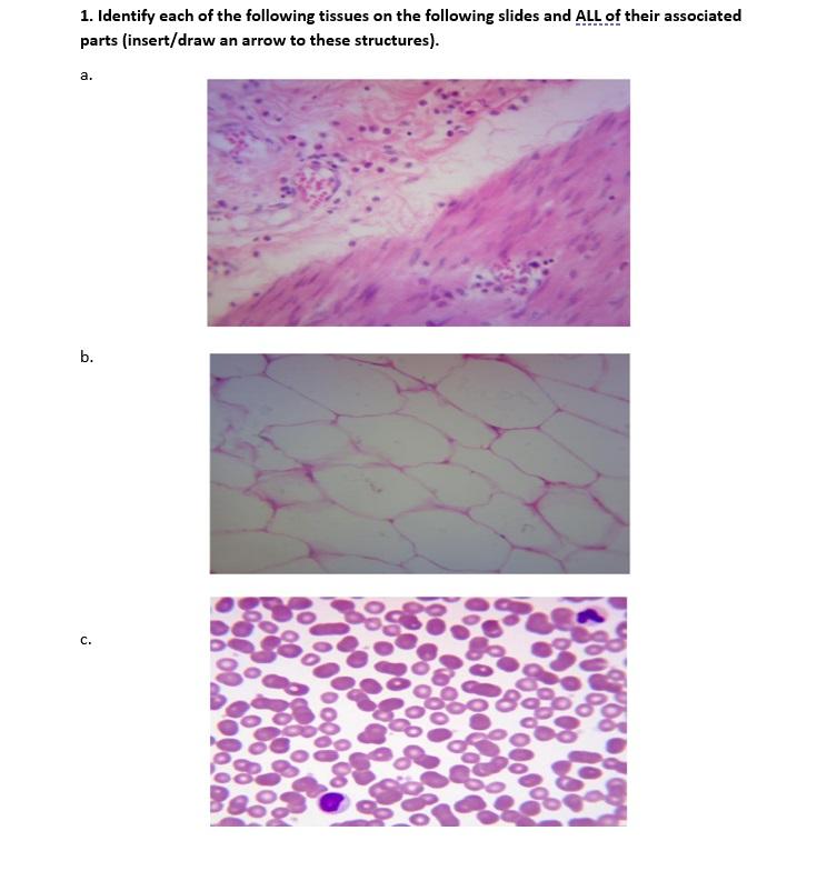 1. Identify each of the following tissues on the | Chegg.com