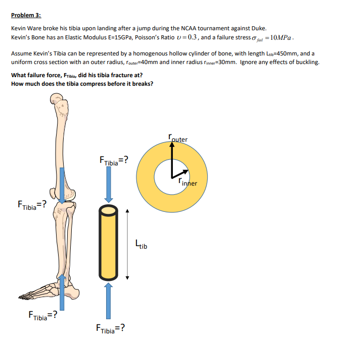 Problem 3: Kevin Ware broke his tibia upon landing | Chegg.com