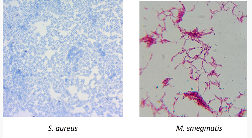 Why are the S. aureus cells blue, while the M. | Chegg.com
