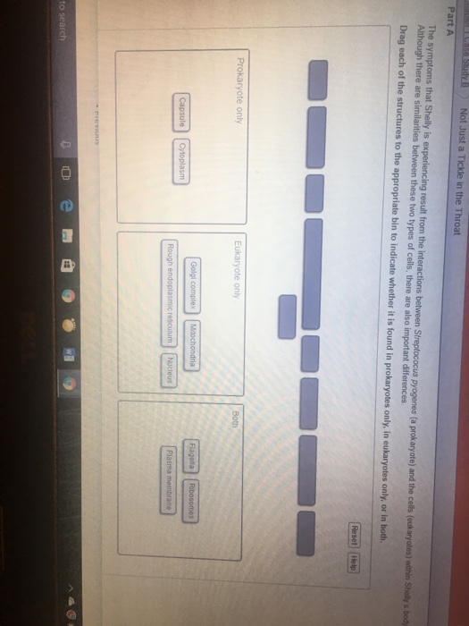 Solved The symptoms that Shelly is experiencing result from | Chegg.com Solved The symptoms that Shelly is experiencing result from | Chegg.com