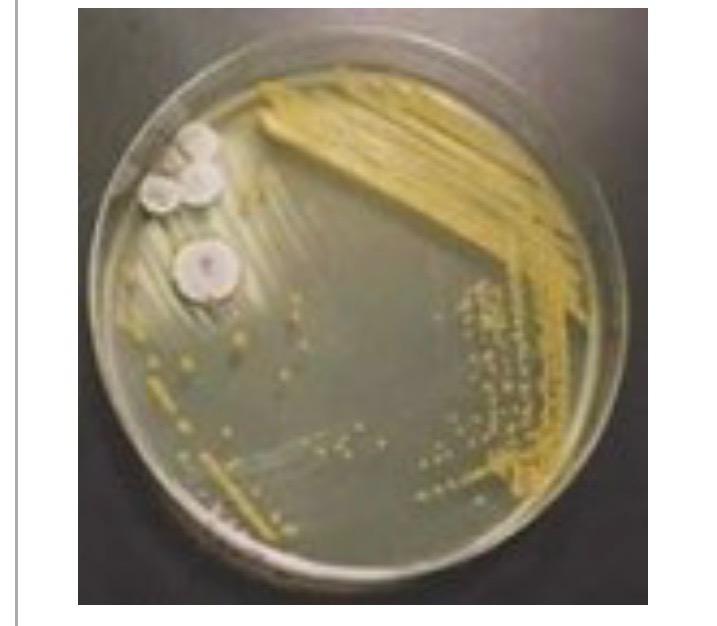 Solved 10. which streak plate has a pure culture? A. B B. | Chegg.com
