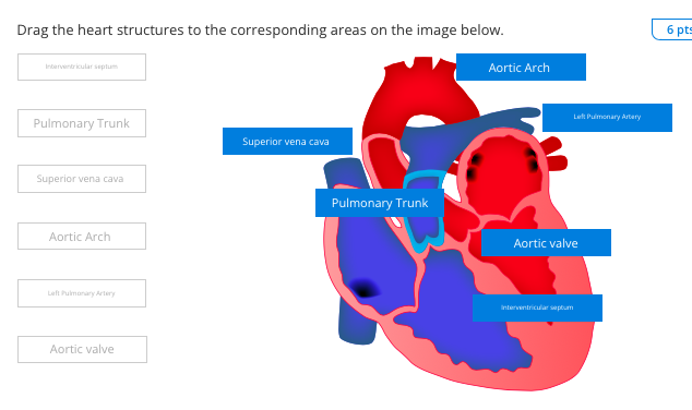 Solved Drag the heart structures to the corresponding areas | Chegg.com