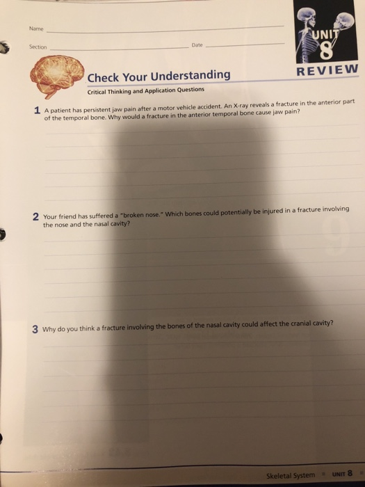 Solved Name Section NIT Check Your Recall REVIE W 1 Label | Chegg.com